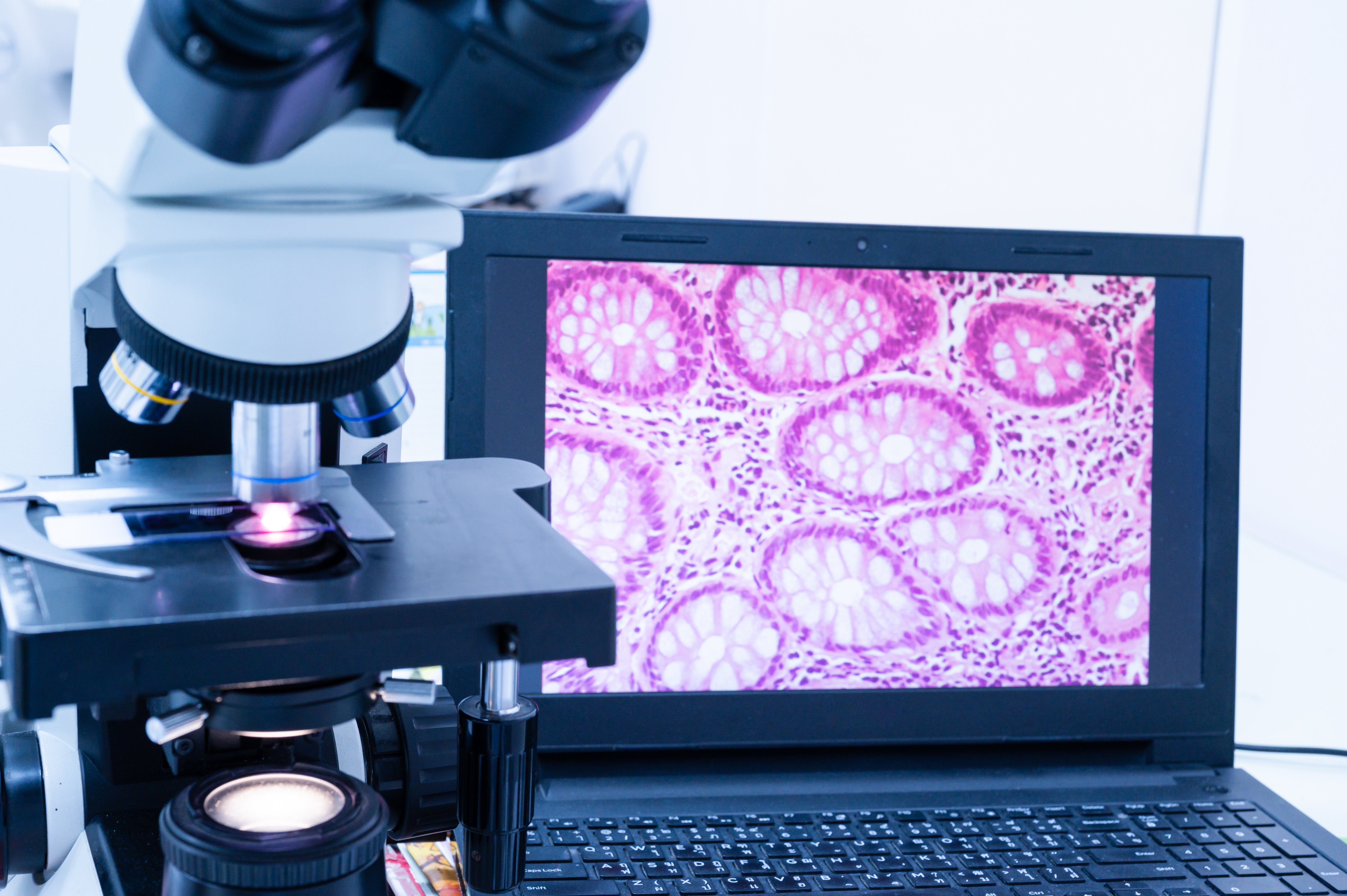 Broadening the Scope of Pathology: How Mikroscan Delivers Telepathology ...